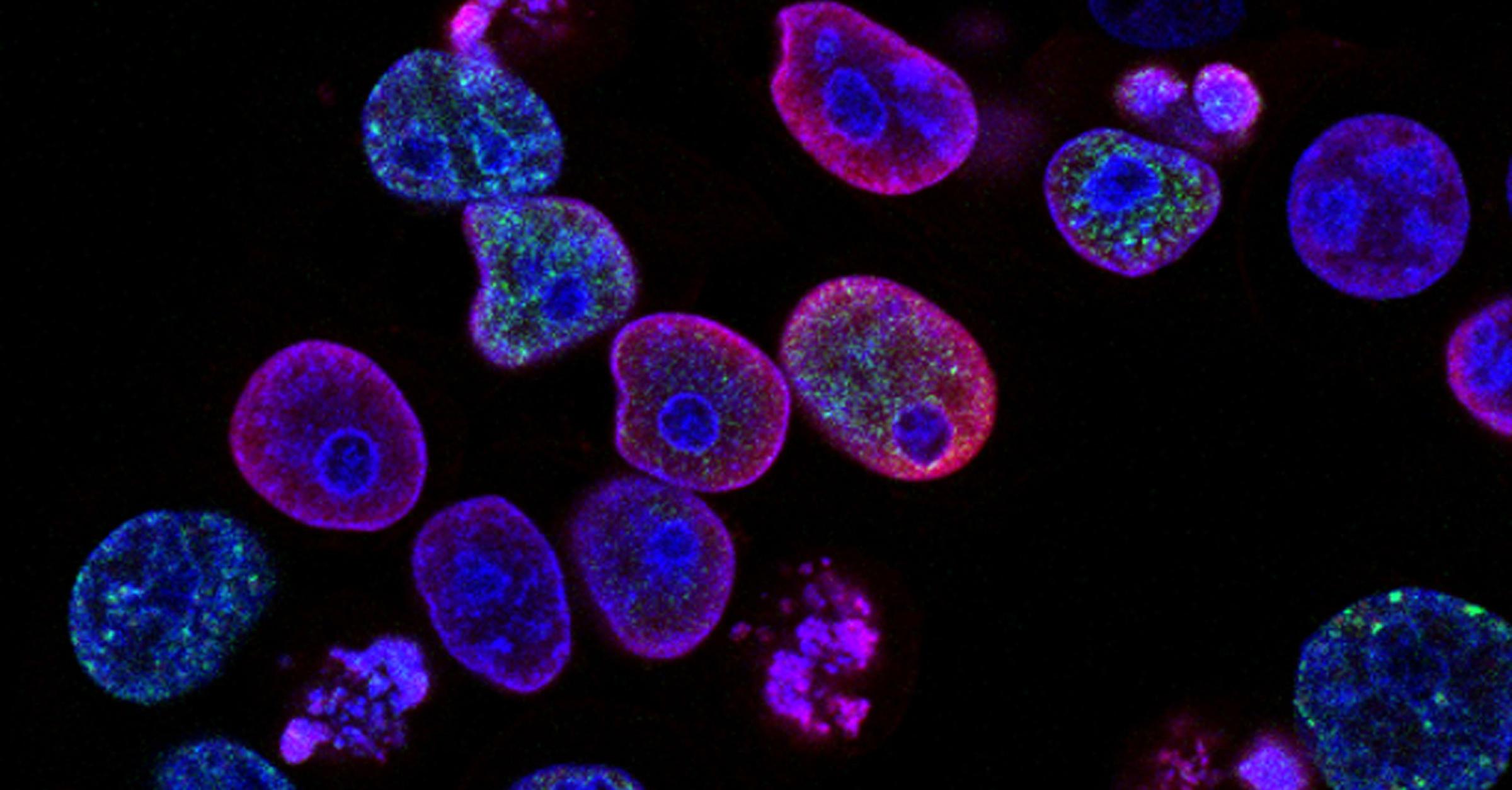 ATMP Manufacturing: an overview for the pharma and biotech sectors | blog