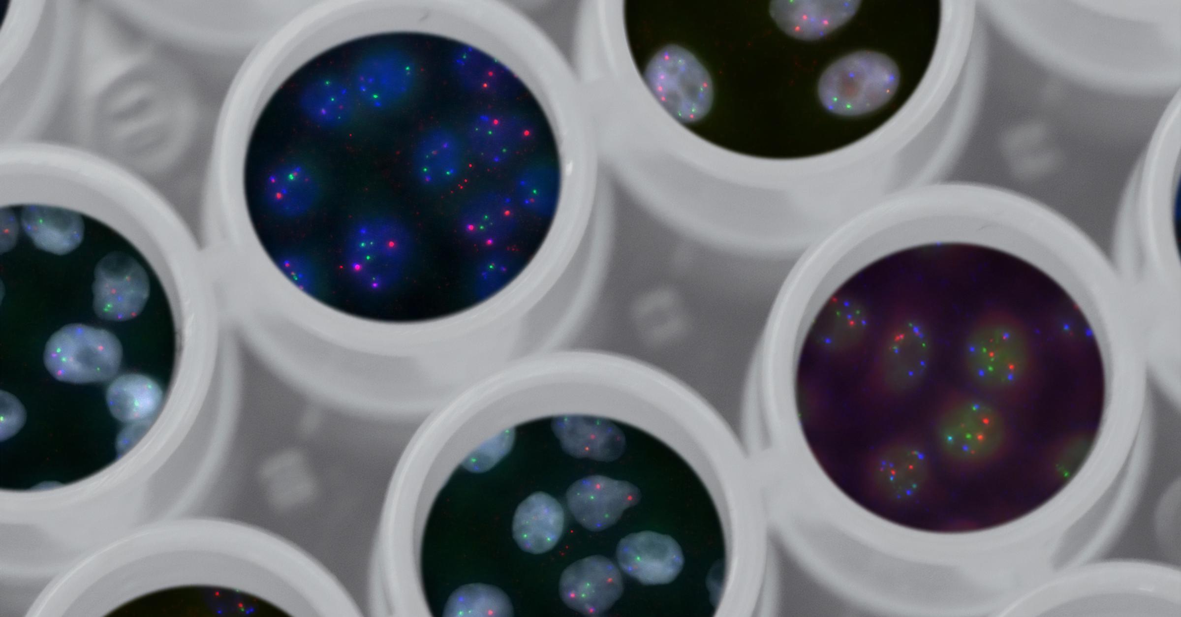 Ensuring quality and compliance in ATMP manufacturing: the Importance ...